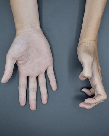 Hand Surgery | Trauma | Specialist Paediatric Surgeon
